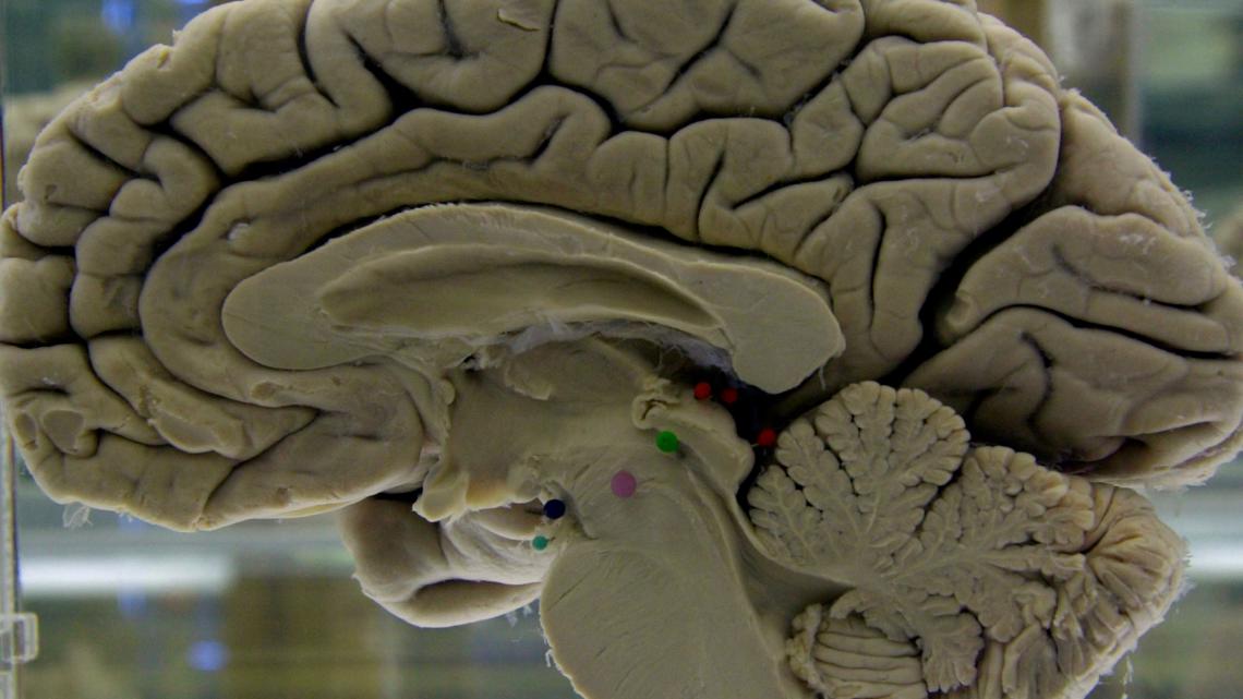 Your brain isn't fully 'adult' until age 32, scientists say | 13wmaz.com
