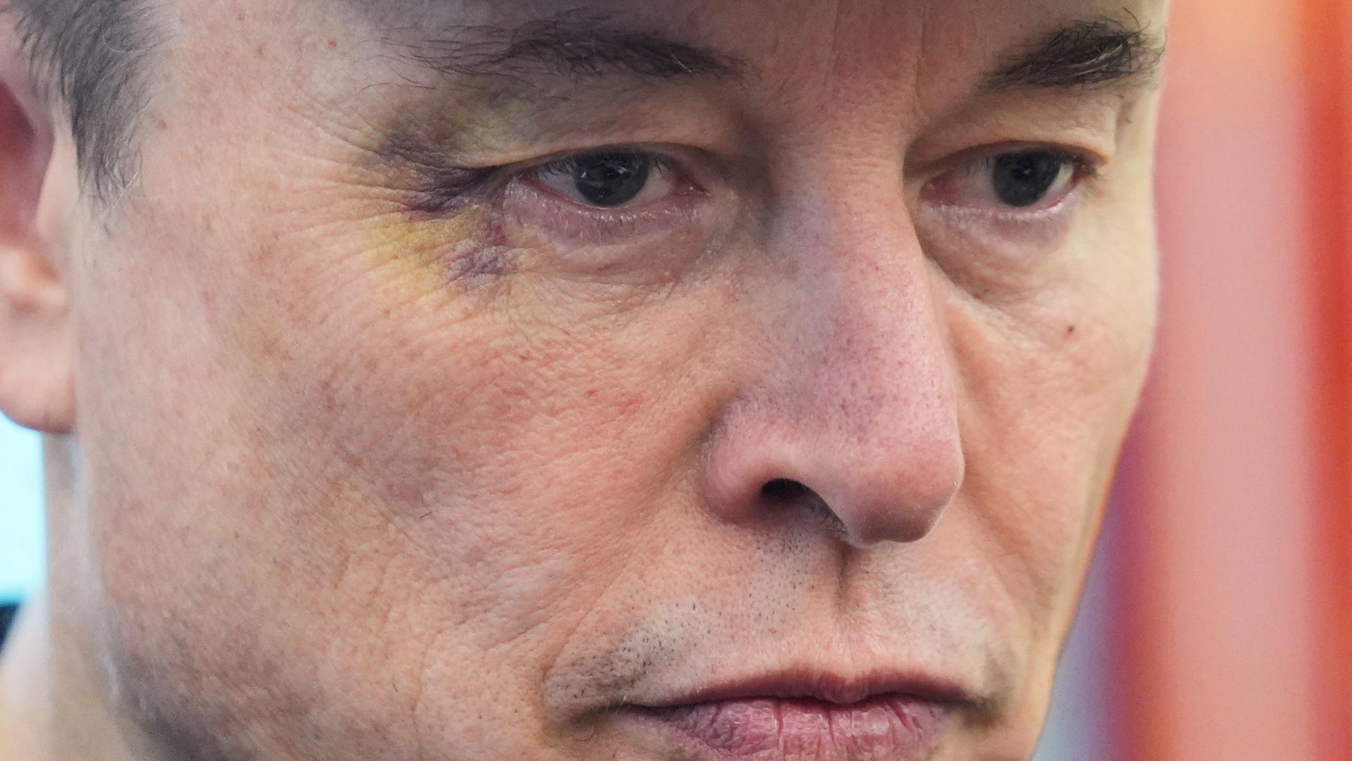 Elon Musk explains his black eye at Oval Office goodbye event with ...