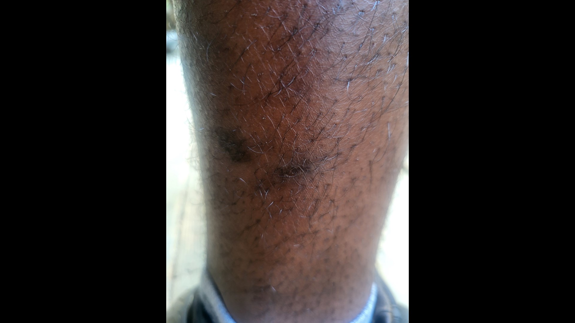 Teen, family question police use of force at football game after Taser ...