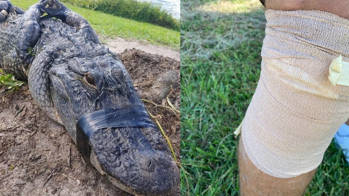 Florida man fights off alligator during attack | 13wmaz.com