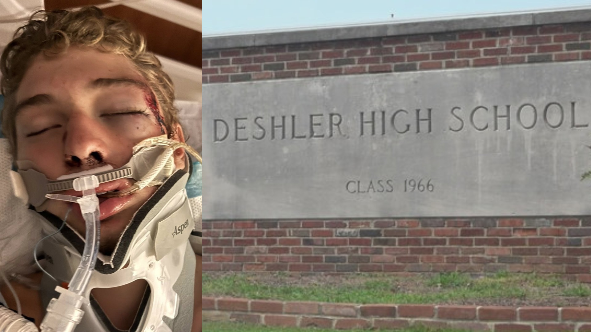 Tuscumbia Schools offer support after student injury | 13wmaz.com